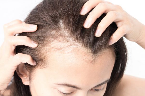 How Much Hair Loss Is Normal And When Should You Be Concerned ...